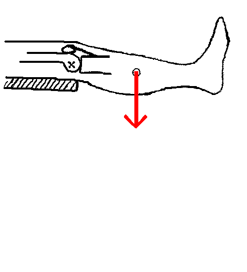 lateral view of knee
