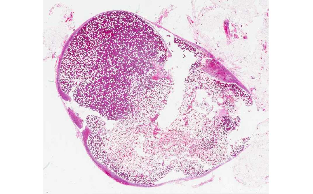 OU Pathology for Medical Students