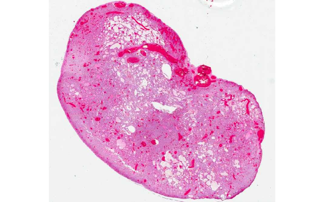 OU Pathology for Medical Students